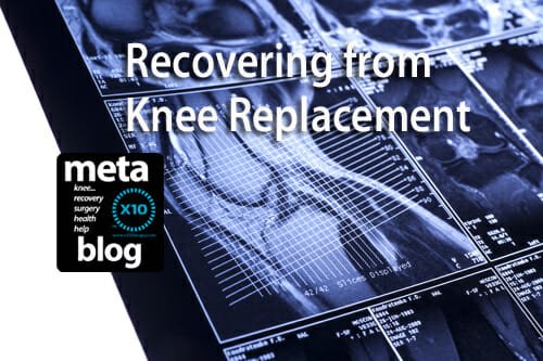 Recovering-From-Knee-Replacement | X10 Therapy