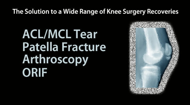 ACL-PATELLA-FRACTURE-ARTHROSCOPY | X10 Therapy