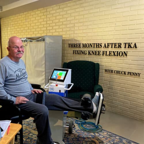 THREE MONTHS AFTER TKA: POOR FLEXION